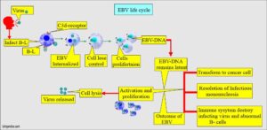 Epstein-Barr virus (EBV) and Infectious mononucleosis