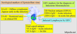 Epstein-Barr virus (EBV) and Infectious mononucleosis