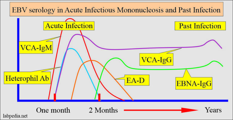 Epstein-Barr virus (EBV) and Infectious mononucleosis
