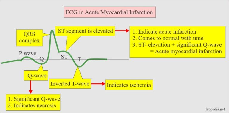 Cardiac marker:- Part 1 - Diagnosis of Acute Myocardial Infarction, AMI ...
