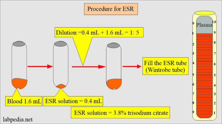 Erythrocyte sedimentation rate (ESR) solution and procedure