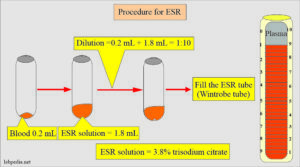 Erythrocyte sedimentation rate (ESR) solution and procedure