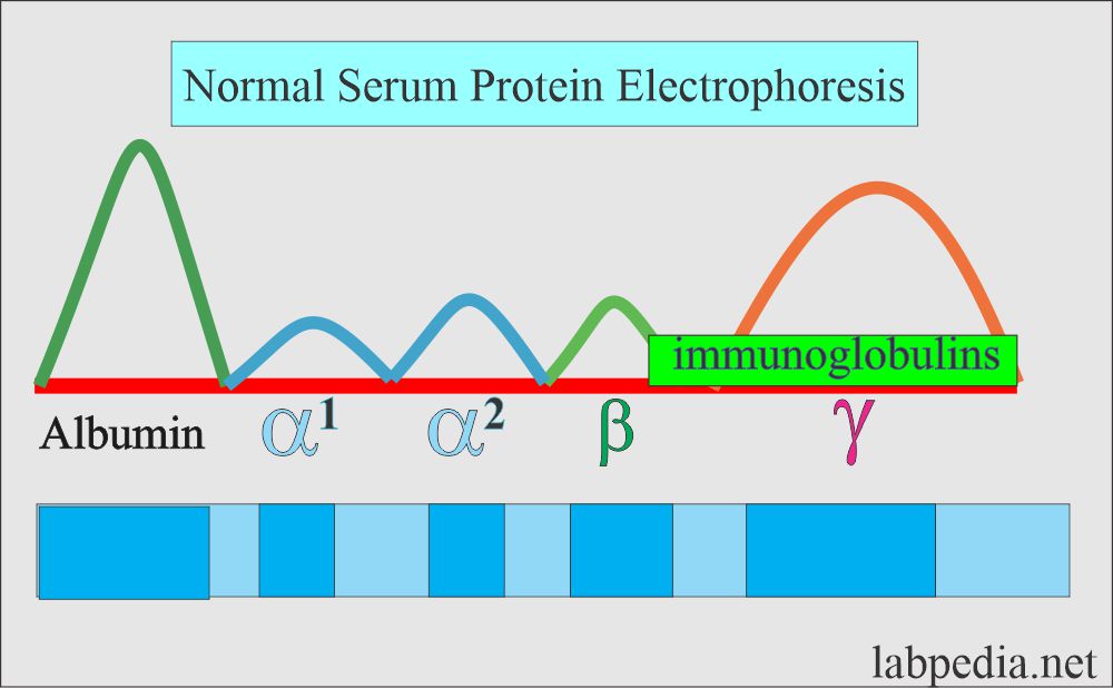 Serum Protein Electrophoresis Procedure Total Protein 43 OFF