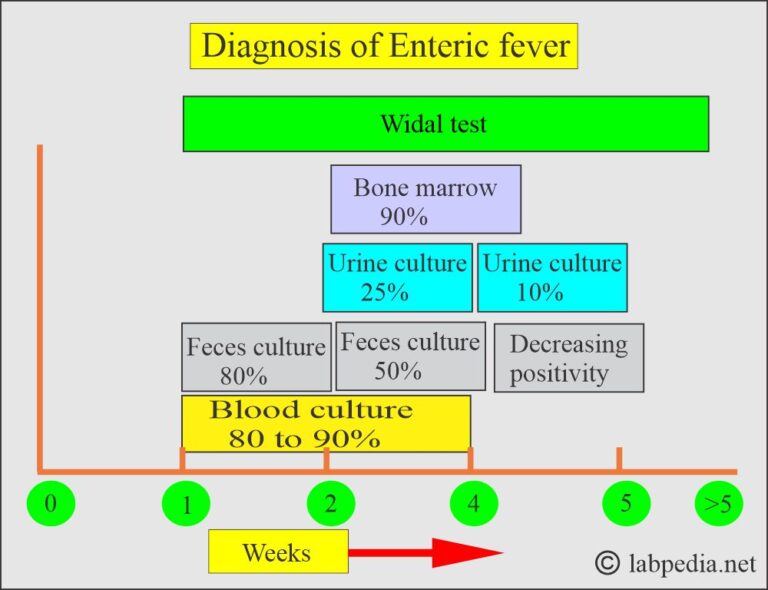 Enteric fever, widal test interpretations