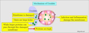 Fluid Analysis, Normal Findings of Various Body Fluids