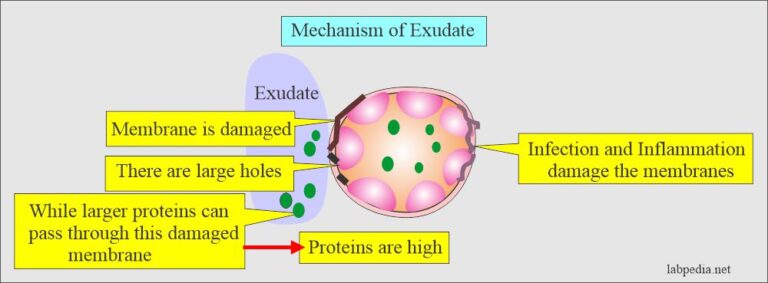 Fluid Analysis, Normal Findings of Various Body Fluids