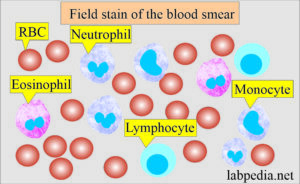 Field Stain A and B solution preparation and staining...