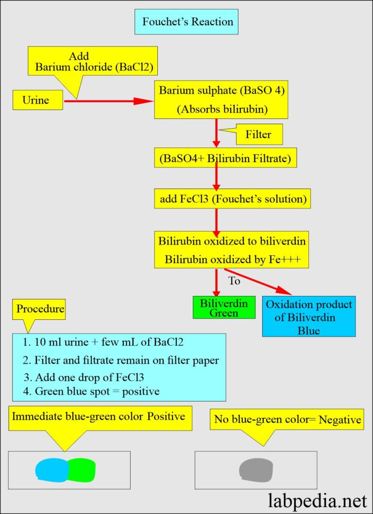 Urine Bilirubin, Bilirubinuria - Labpedia.net