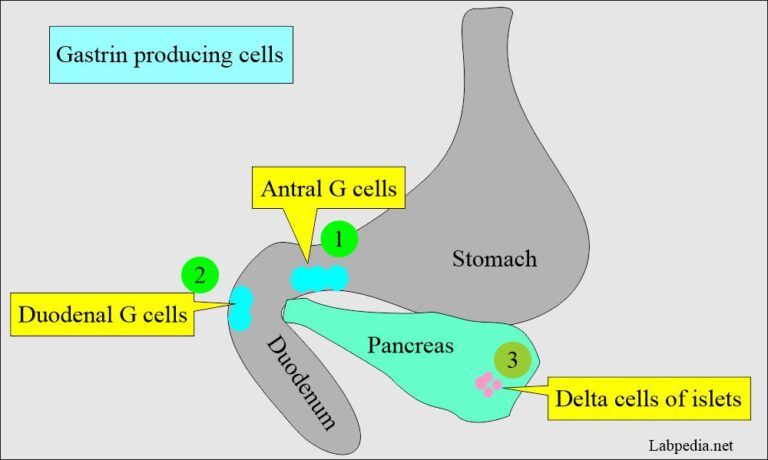 Zollinger-Ellison Syndrome, gastrinoma
