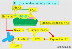 Helicobacter Pylori, H. Pylori, Presentation and Diagnosis