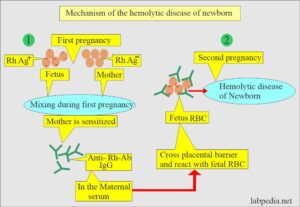 Hemolytic disease of newborn (HDN), and coombs test
