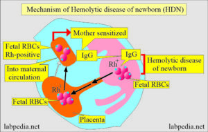 Hemolytic disease of newborn (HDN), and coombs test