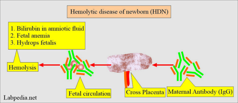 Hemolytic disease of newborn (HDN), and coombs test