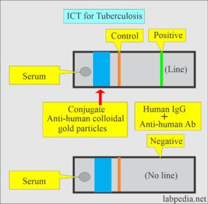 Mycobacterium Tuberculosis:- Part 7 - Tuberculosis Test by ICT ...