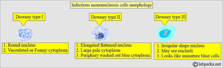 Epstein-Barr virus (EBV) and Infectious mononucleosis
