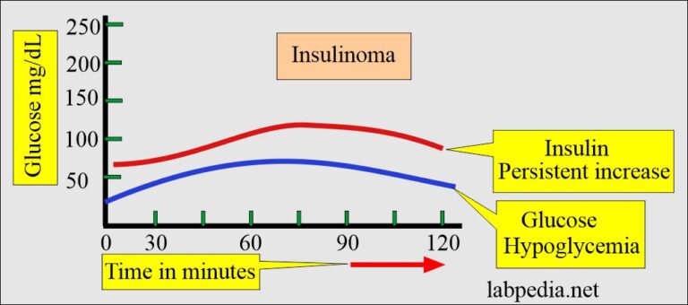 Insulin level (Insulin Assay) - Labpedia.net