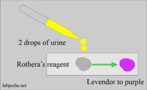 Diabetic ketoacidosis, ketone bodies and management