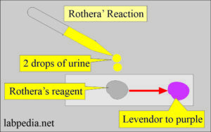 Urine Analysis:- Part 1 - Complete Urine Analysis Discussion - Labpedia.net