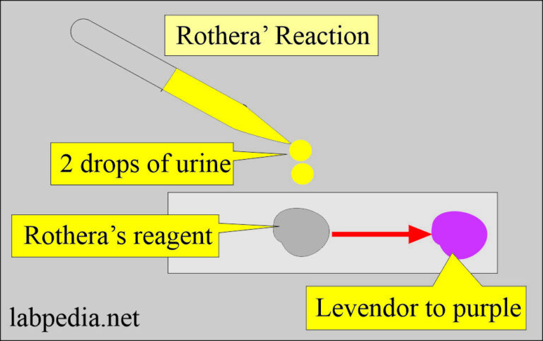 Urine Analysis:- Part 1 - Complete Urine Analysis Discussion - Labpedia.net