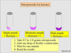 Diabetic ketoacidosis, ketone bodies and management