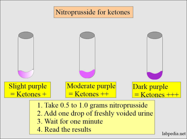 Diabetic ketoacidosis, ketone bodies and management