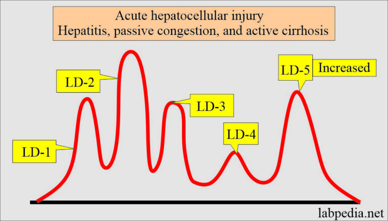 Lactate Dehydrogenase (LDH), Isoenzymes of LDH