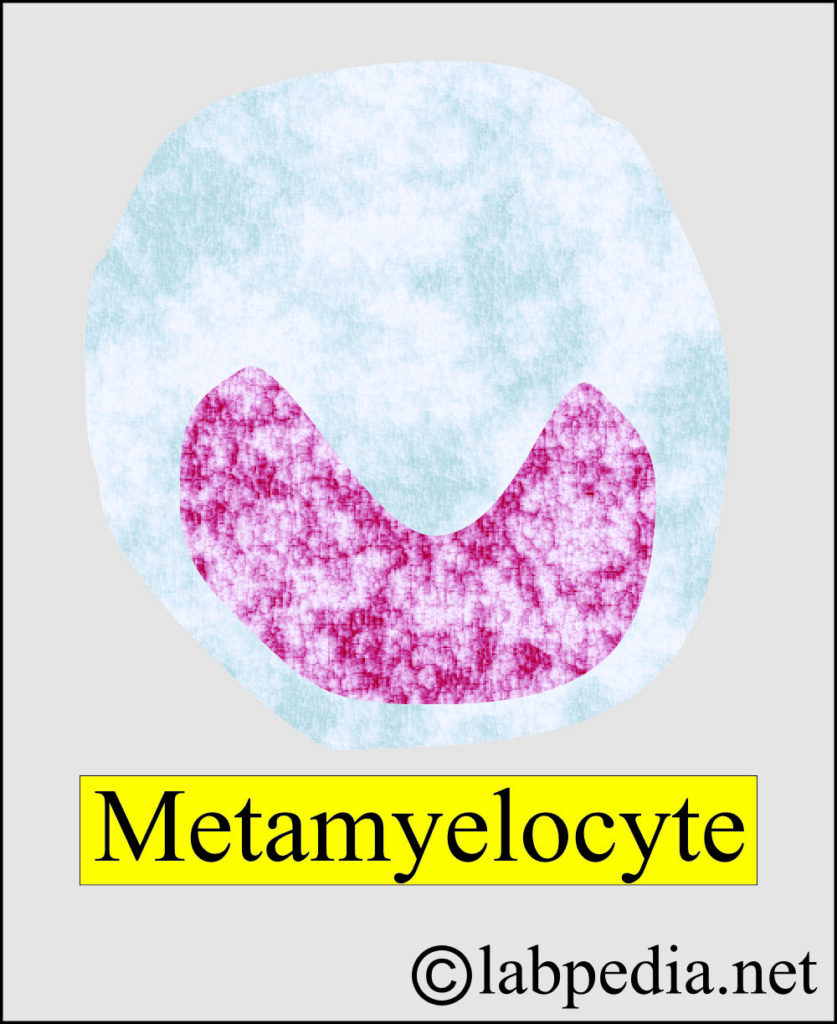 Bone Marrow Aspiration and Trephine Biopsy, Myeloerthyropoeisis Part 1 ...