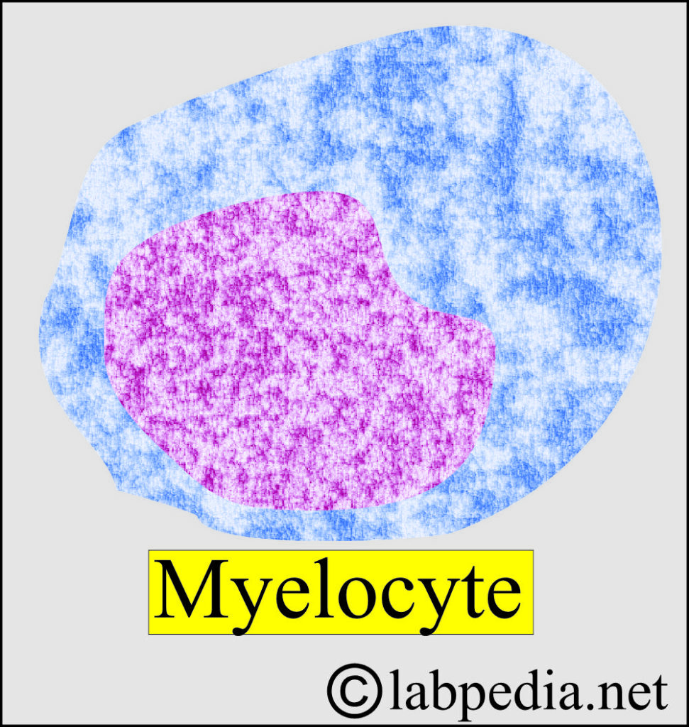 Bone Marrow Aspiration and Trephine Biopsy, Myeloerthyropoeisis Part 1 ...
