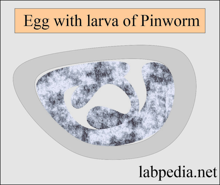 Parasitology:- Common Parasites Pictures - Labpedia.net