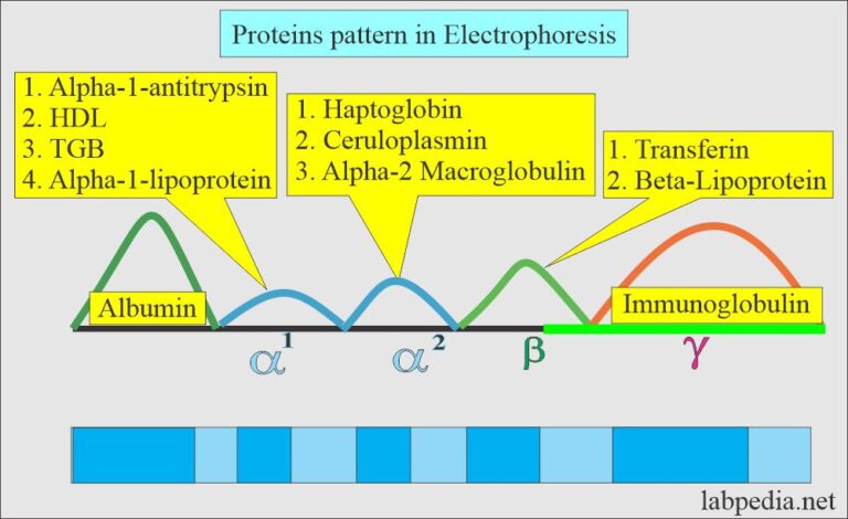 Serum Protein Electrophoresis, Total protein, albumin and globulin ...