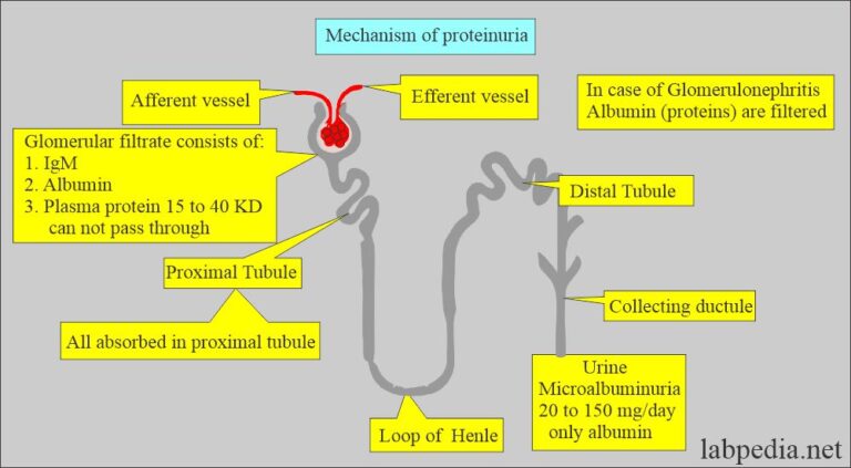 Urine protein 24-hour, Classification of Proteinuria - Labpedia.net