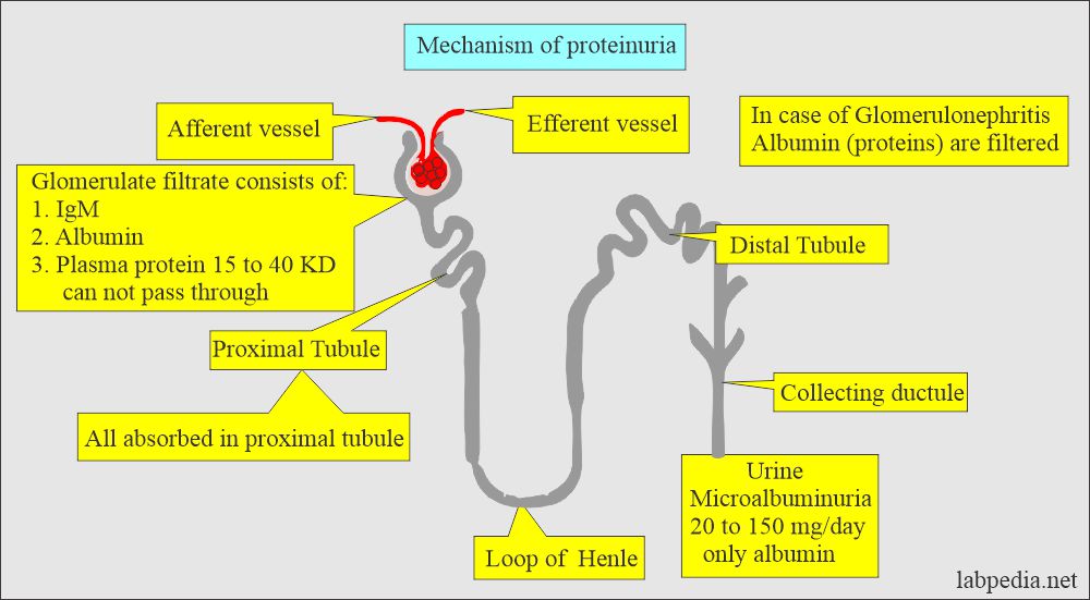 Urine Protein Proteinuria Spot Test Microalbuminuria Labpedia Urine Protein Proteinuria Spot Test Microalbuminuria Labpedia