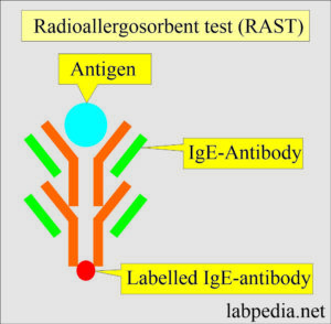 IgE antibody level, Allergy blood testing