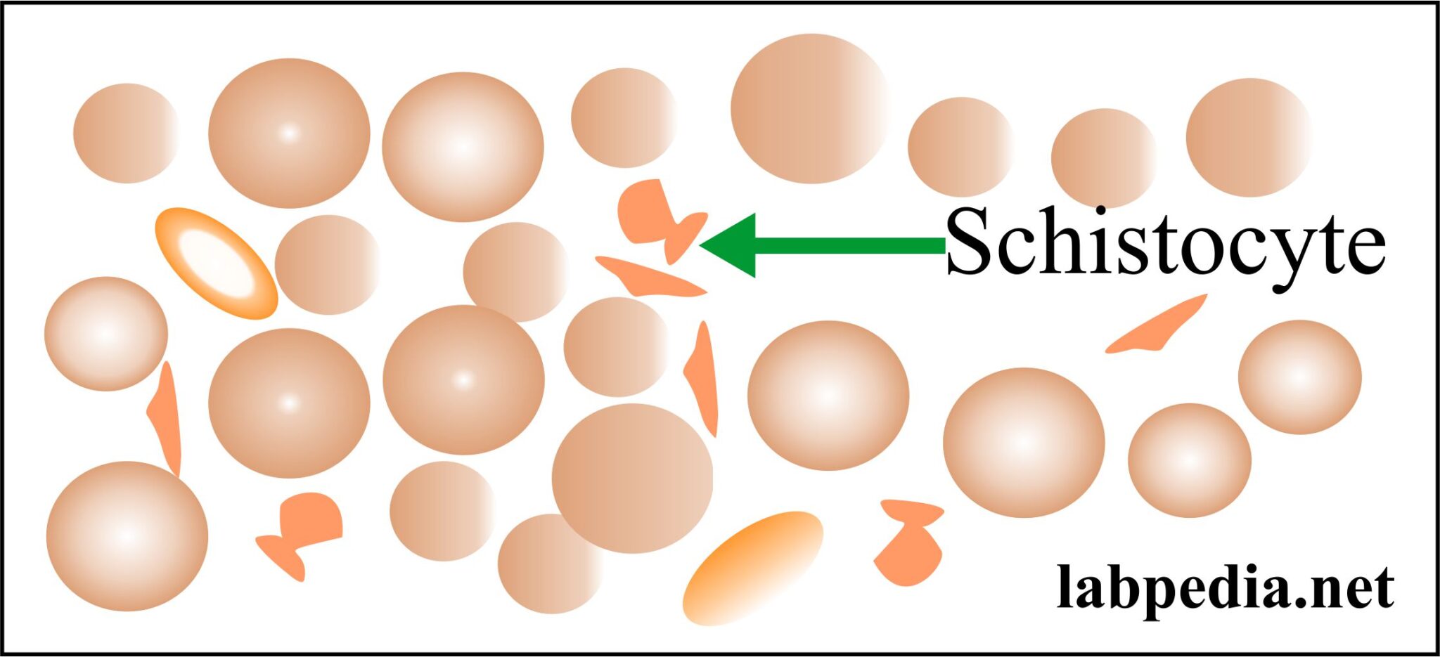 Red Blood Cell (RBC):- Part 2 - Normal Peripheral blood smear, and RBC ...