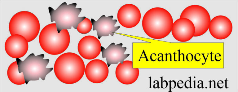 Red Blood Cell (RBC):- Part 5 - Summary of RBC Morphology ...