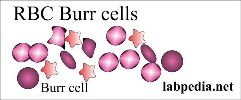 Red Blood Cell (RBC):- Part 2 - Normal Peripheral blood smear, and RBC ...
