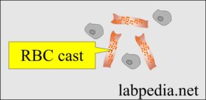 Urine Analysis:- Part 2 -Urine Microscopic Examination and ...
