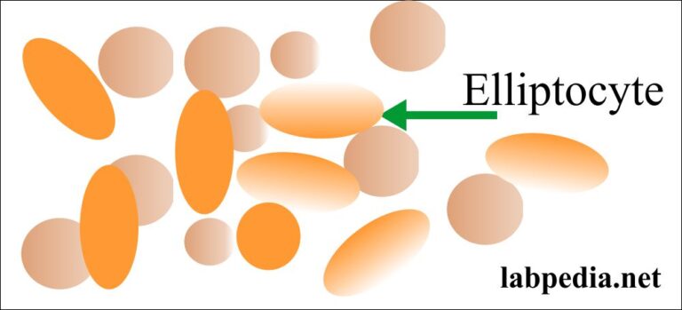 Anemia classification, diagnosis, and routine workup