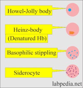 Red Blood Cell (RBC):- Part 2 - Normal Peripheral blood smear, and RBC ...