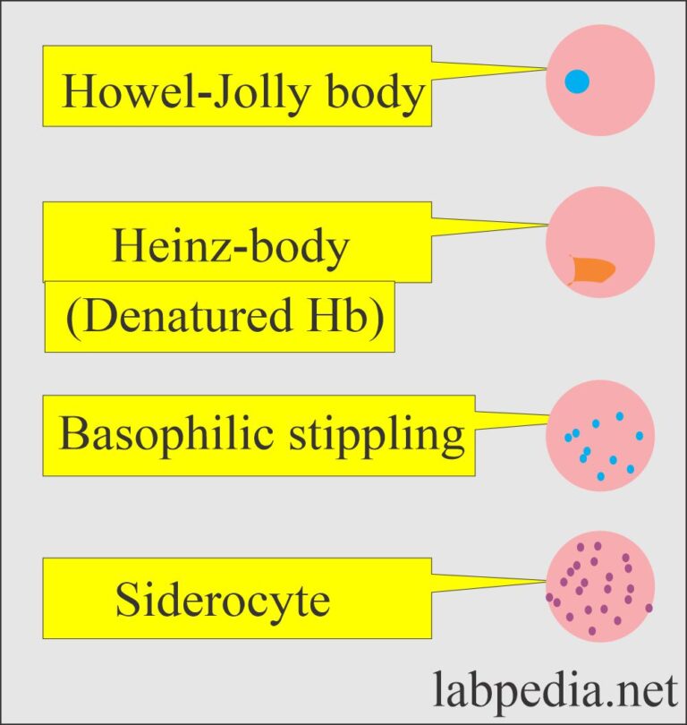 Red Blood Cell (RBC):- Part 2 - Normal Peripheral blood smear, and RBC ...