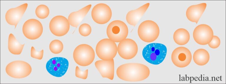 Red Blood Cell (RBC):- Part 5 - Summary of RBC Morphology ...