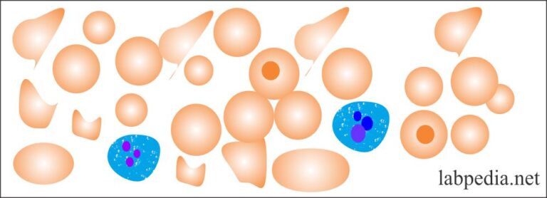 Red Blood Cell (RBC):- Part 5 - Summary of RBC Morphology ...