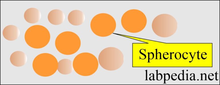 Red Blood Cell (RBC):- Part 3 - Interpretations of Peripheral Blood ...