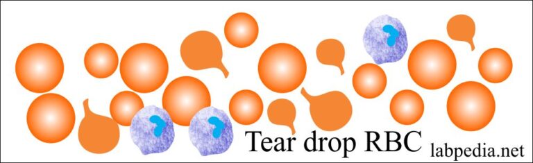 Red Blood Cell (RBC):- Part 2 - Normal Peripheral blood smear, and RBC ...