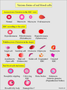 Anemia classification, diagnosis, and routine workup