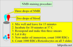 Reticulocyte count (retic count) and interpretations