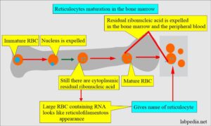 Reticulocyte count (retic count) and interpretations