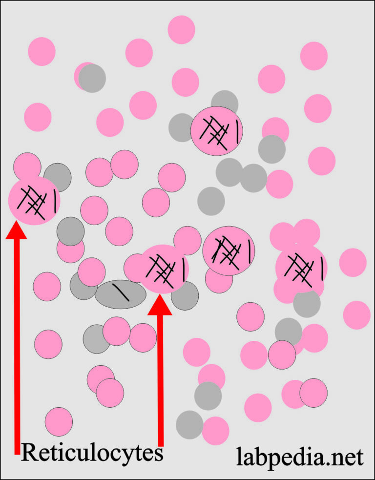 Reticulocyte count (retic count) and interpretations