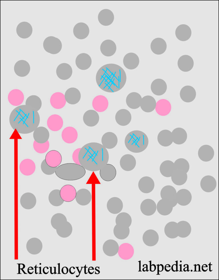 Red Blood Cell (RBC):- Part 2 - Normal Peripheral blood smear, and RBC ...