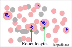 Reticulocyte count (retic count) and interpretations